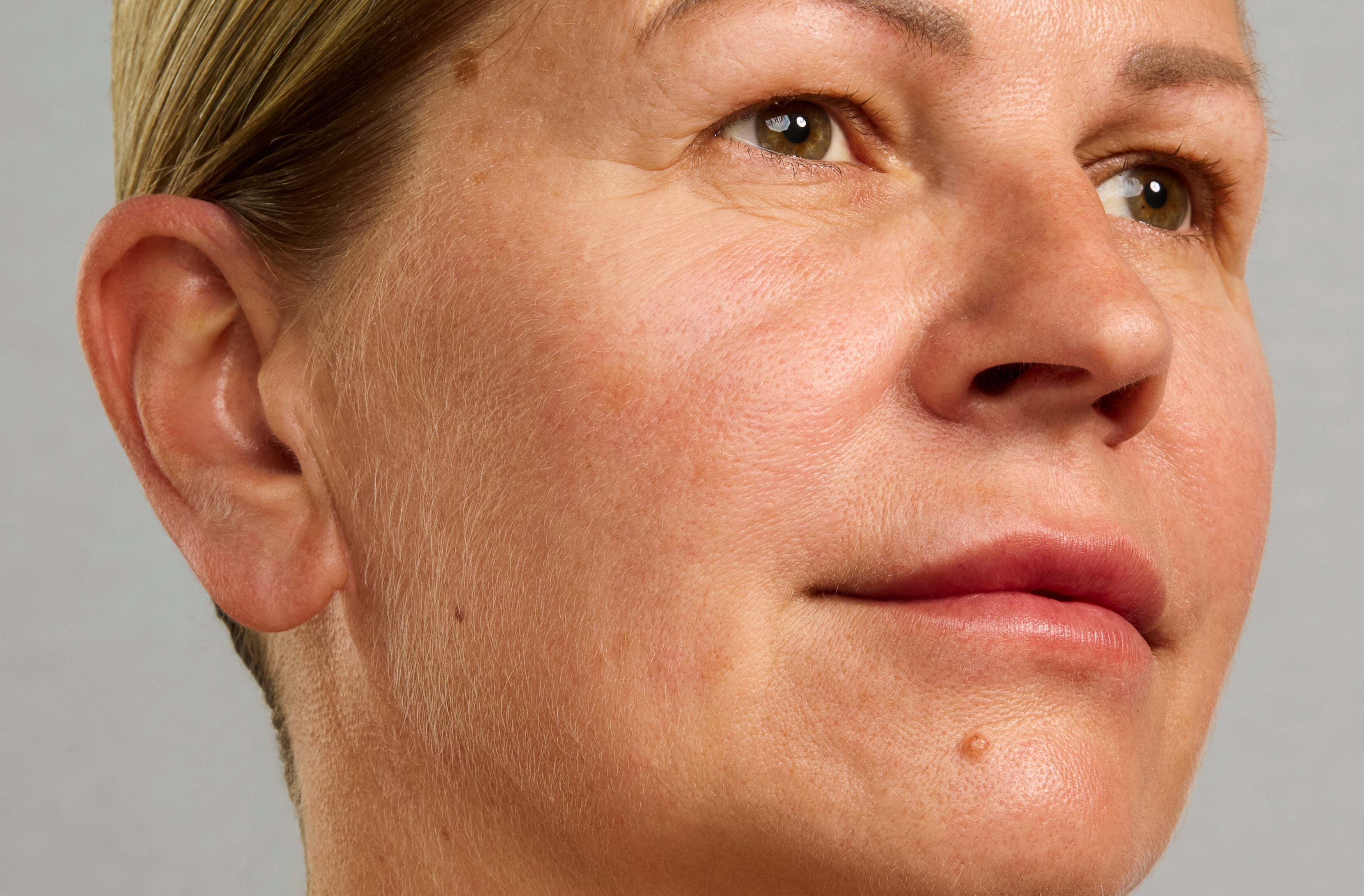 Peach Fuzz & Perimenopause: Your Questions Answered – Dermaflash
